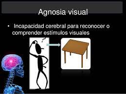 Agnosia Visual Plantilla 1 | Genially